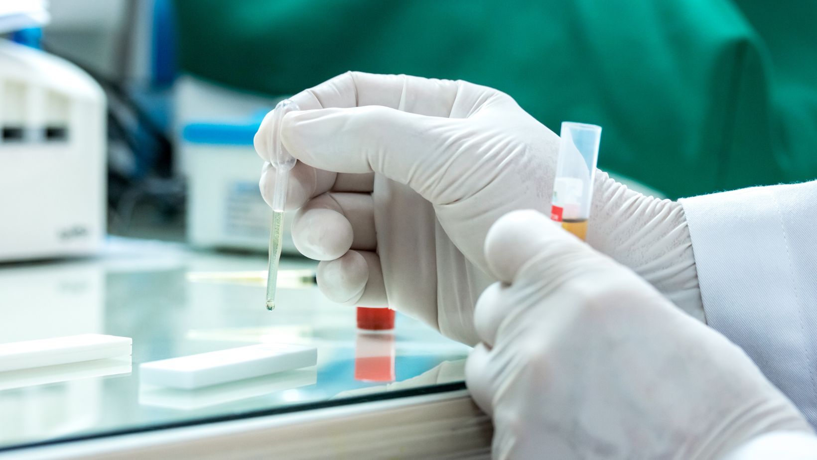 Comparing Drug Testing Methods: Urine, Saliva vs. Hair Tests – An In ...